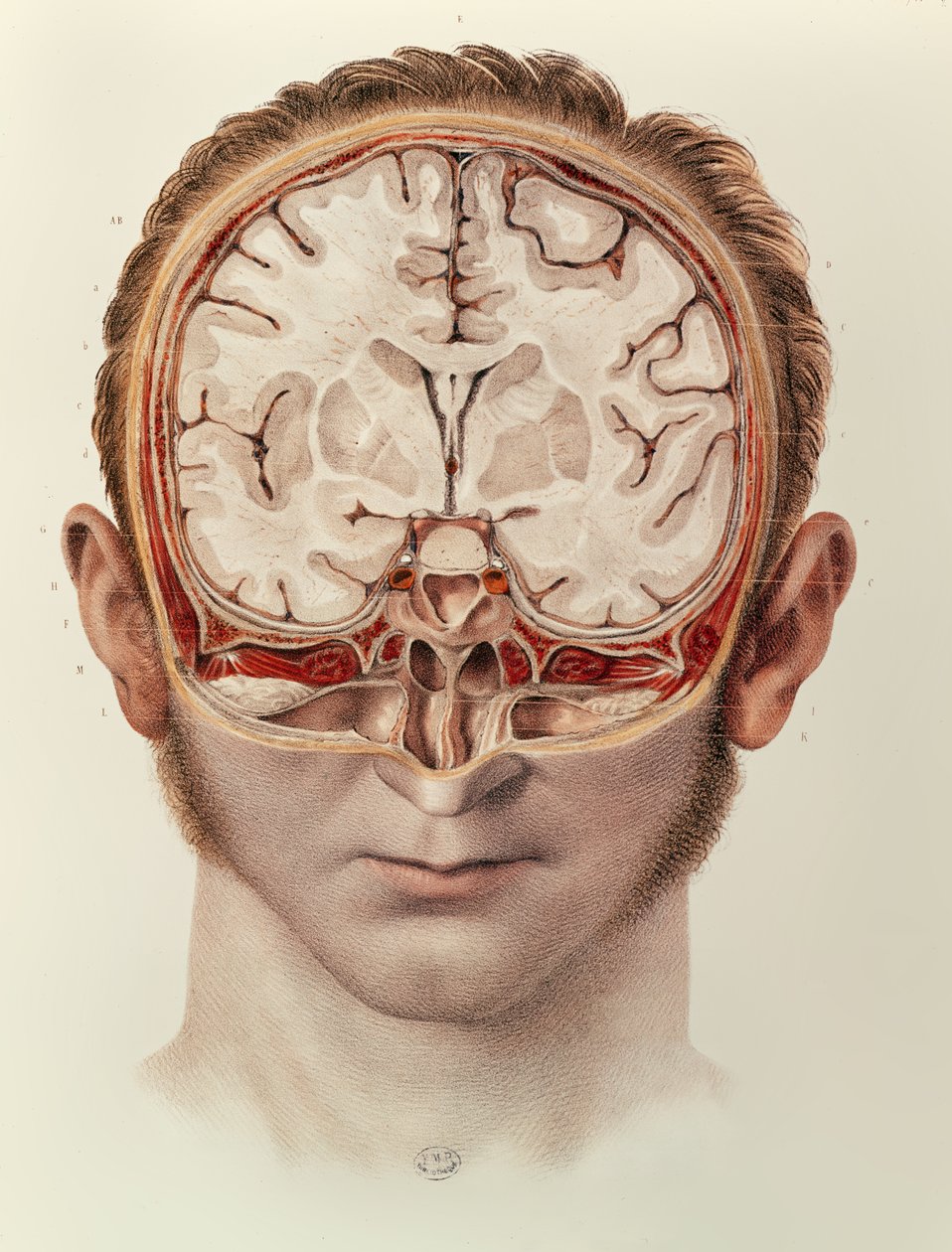 Anatomische Tekening Van De Hersenen